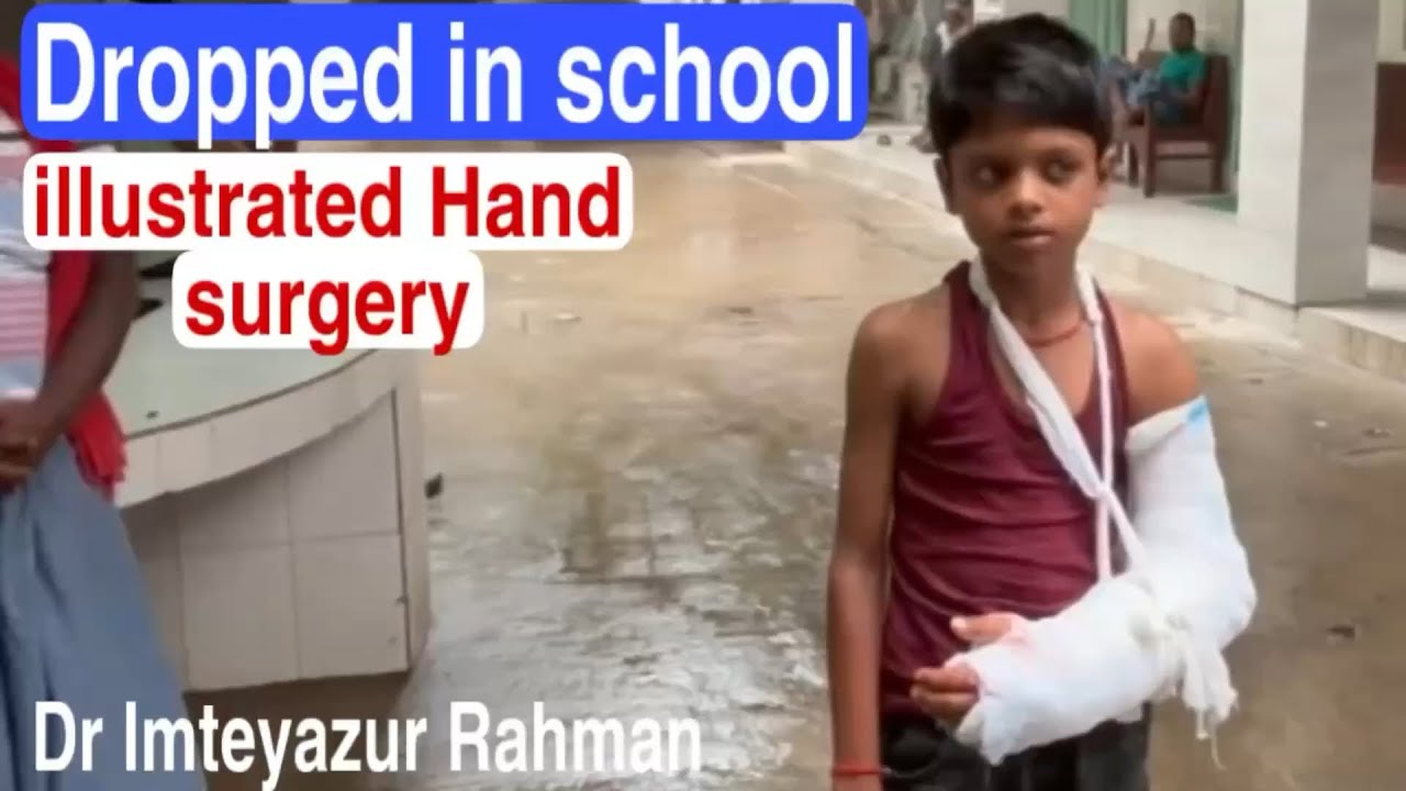 Hand injury with compartment syndrome - YouTube