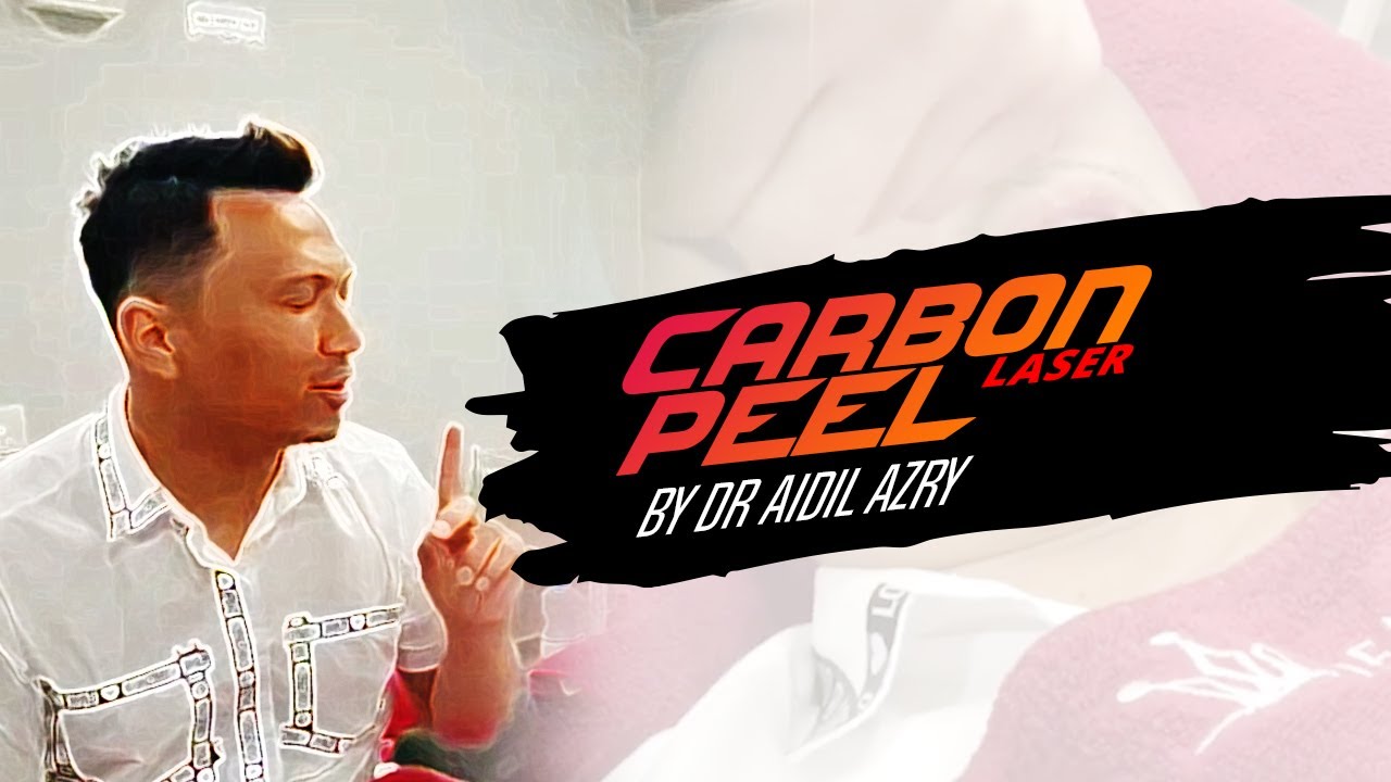 CARBON PEEL TREATMENT BY IDEALYST - DR AIDIL AZRY DATO' MOKHTAR - YouTube