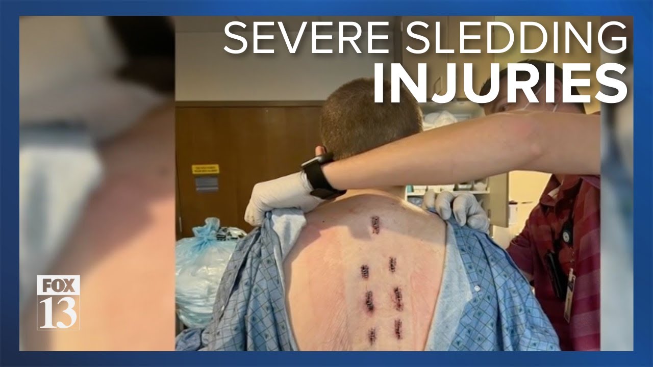 Utahn Recovering From Severe Sledding Accident - YouTube