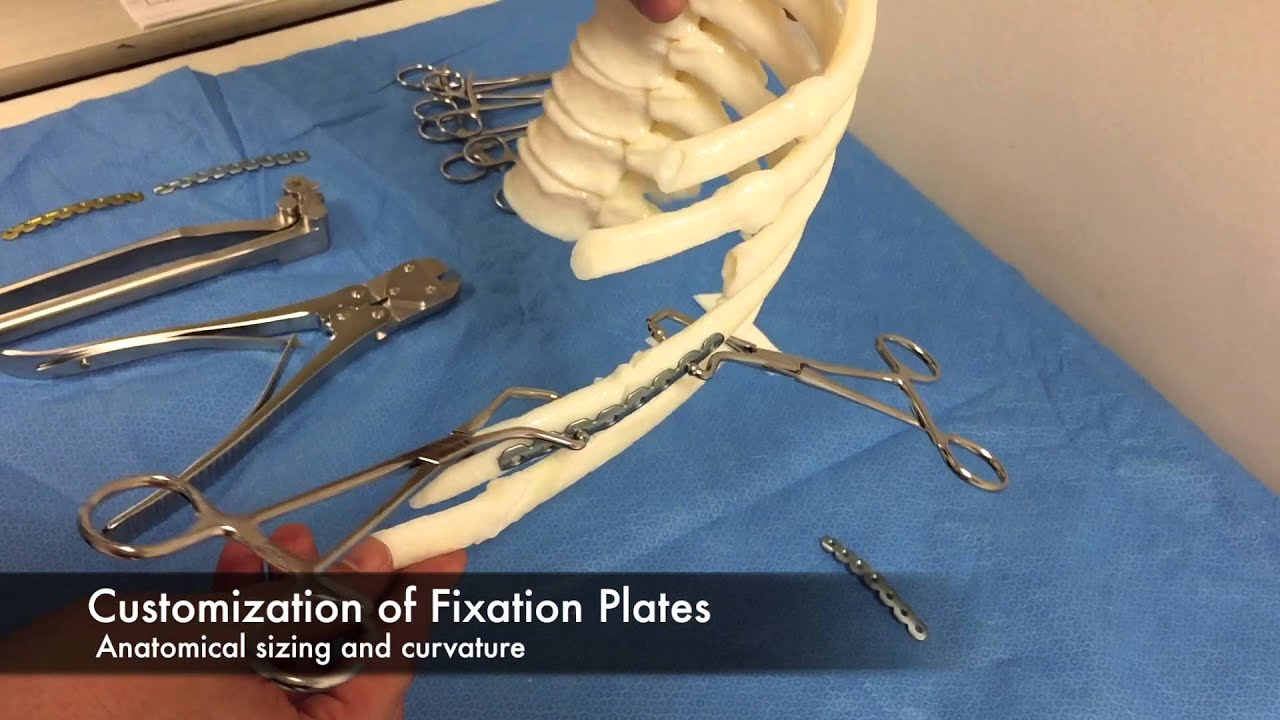 Anatomical Model for Surgical Planning - YouTube