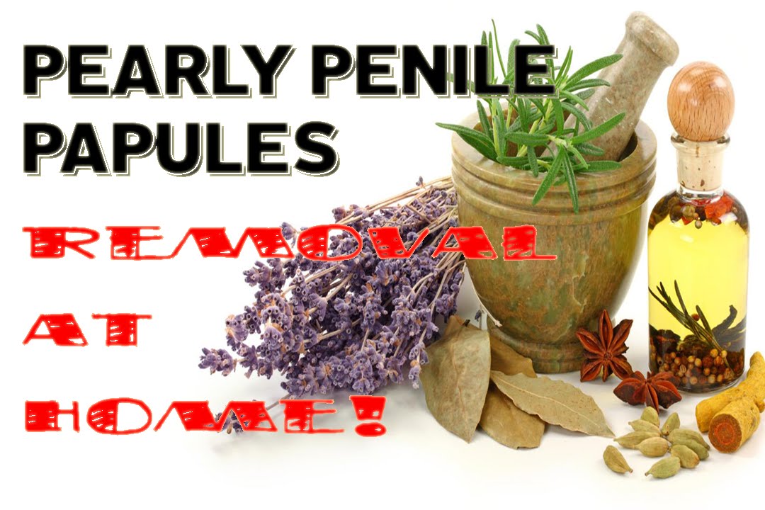 #1 Pearly Penile Papules Removal At Home - YouTube