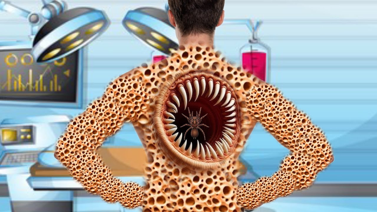 ASMR ANIMATION TREATMENTS 🤕animation treatments serious injury man back ...