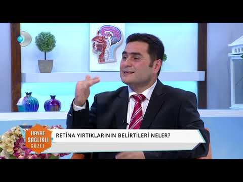 RETİNA YIRTILMASI NEDEN OLUŞUR? DOÇ  DR  METİN EKİNCİ