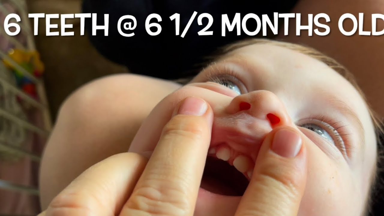 6 Months 6 Teeth - YouTube
