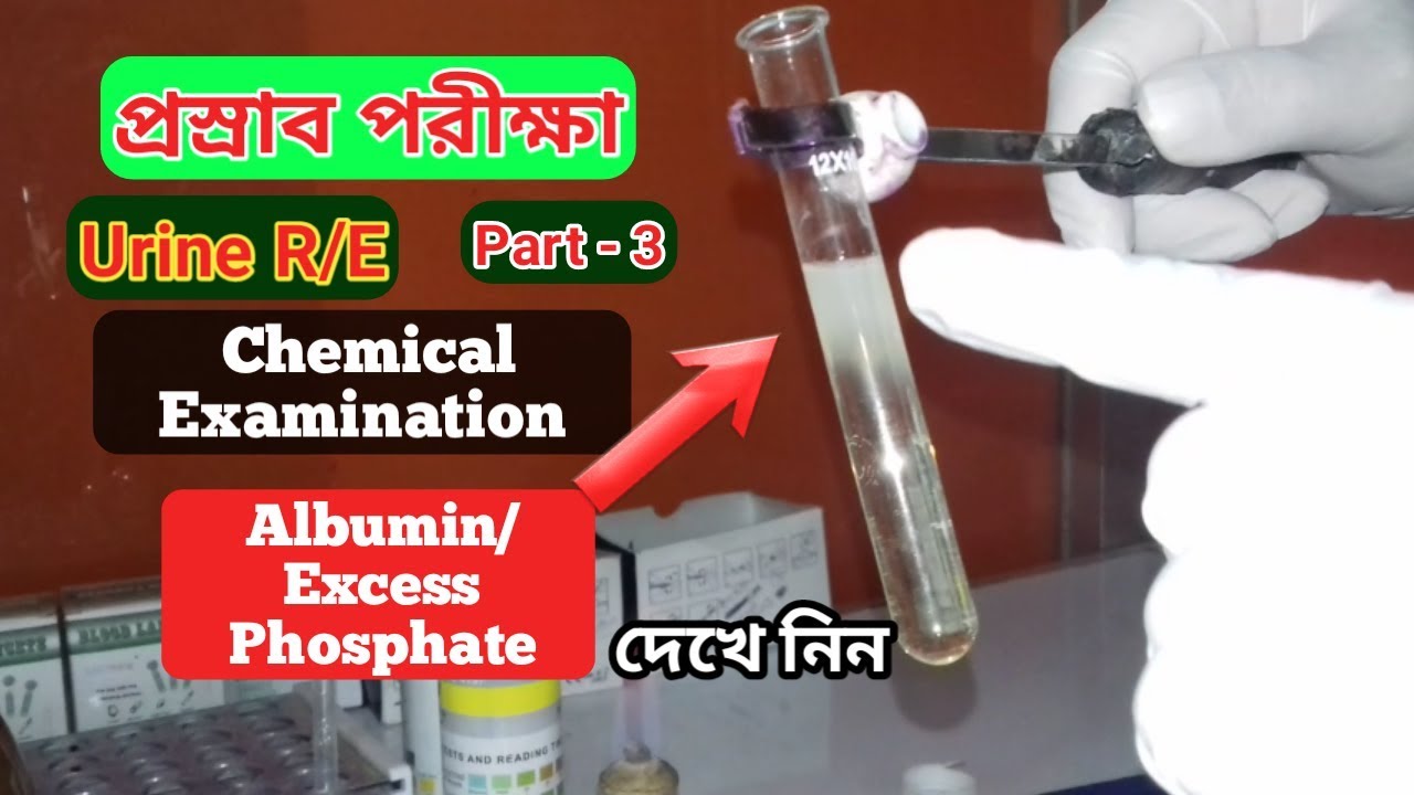 Urine R/E Part- 3 Albumin Test Very Easy Heat and Acitic Acid method ...