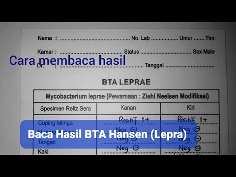Cara Baca Hasil Laboratorium Lepra | Kusta | Studi Kasus - YouTube
