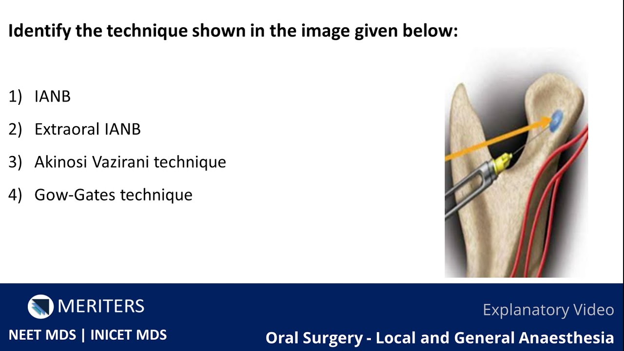 NEET MDS | INICET - Oral Surgery - Local and General Anaesthesia ...