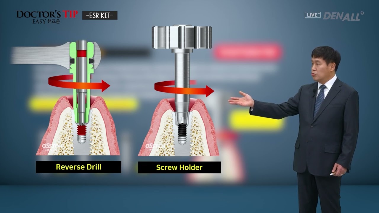 [OSSTEM]Easy Hands on: ep 15 ESR KIT Fractured Screw and Fractured ...