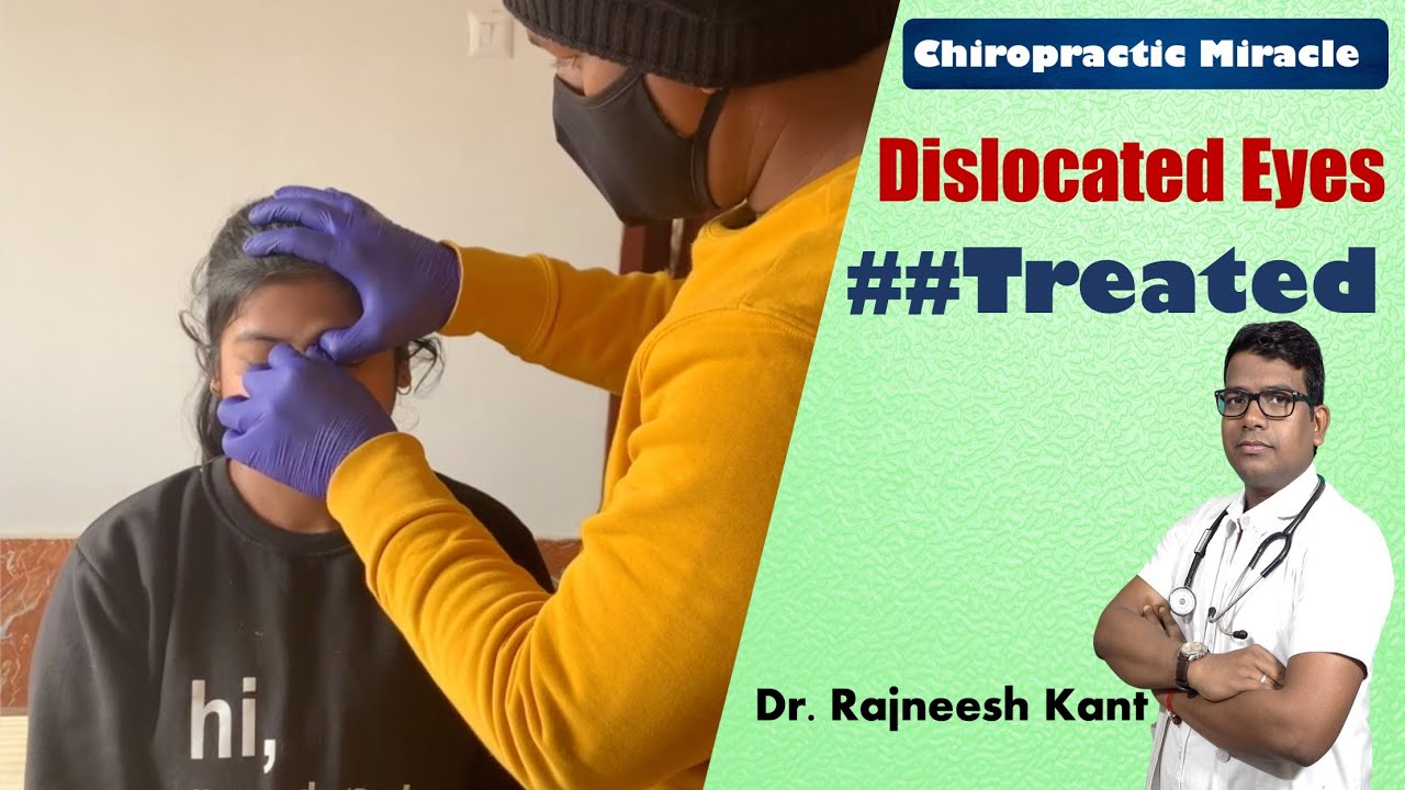 Dislocated Eyes Treated || Chiropractic Miracles || Dr. Rajneesh Kant ...