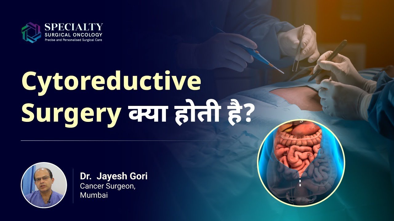 Cytoreductive Surgery क्या होती है? | Stage 4 Cancer Treatment | Dr ...