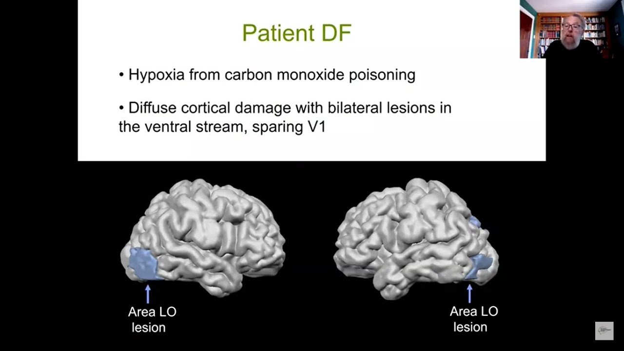 Mel Goodale: How DF and other single-cases have illuminated our ...