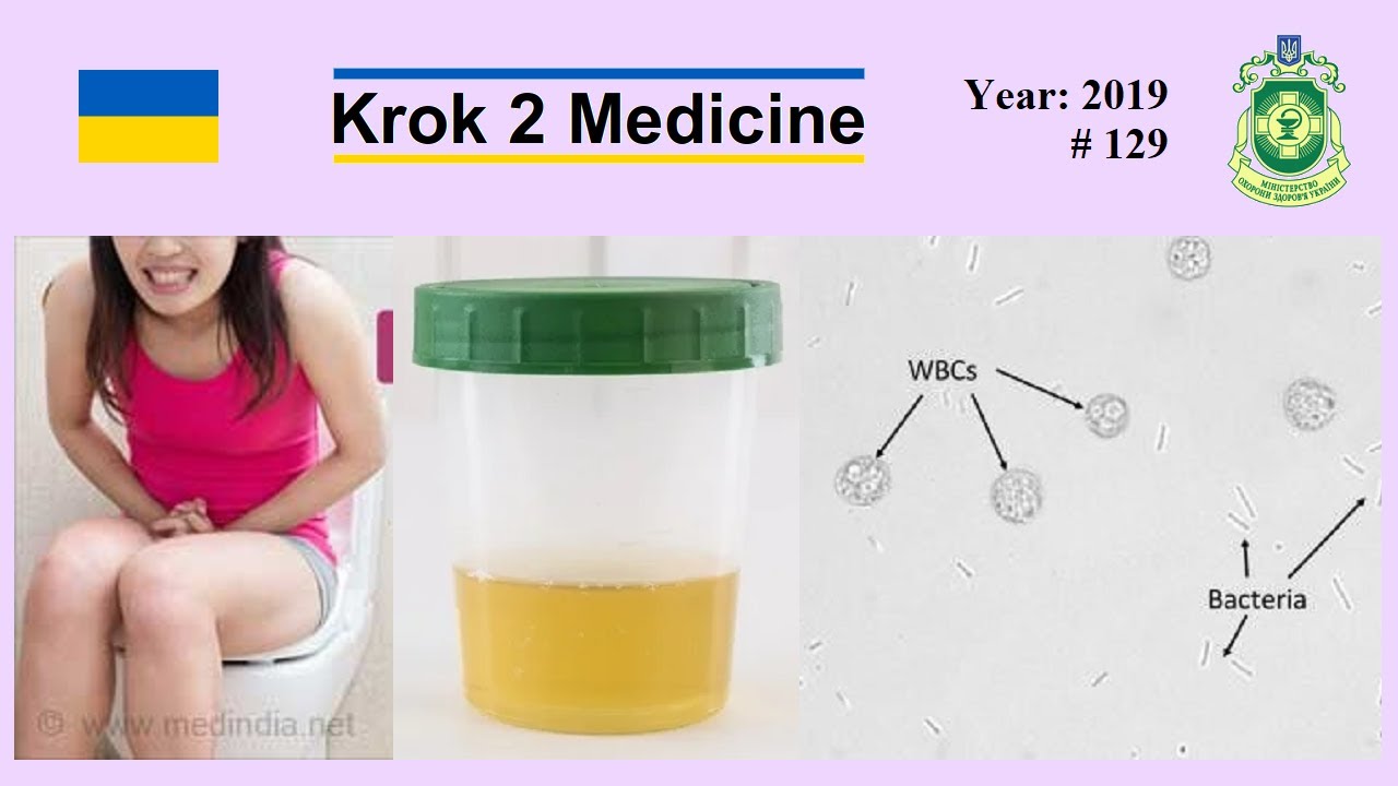 [ Krok 2 Medicine ] Year: 2019 - 129 (Ministry of Public Health of ...