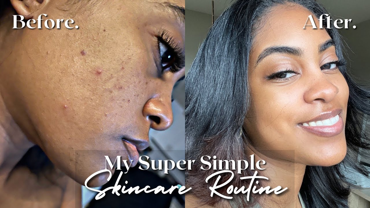 The Simple AM/PM Skincare Routine That Saved My Face | Skincare Routine ...