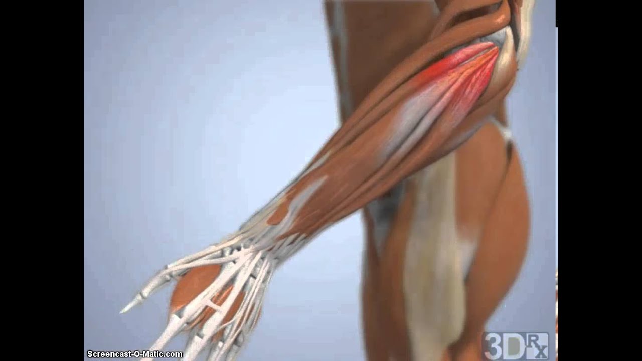 Epicondilitis lateral - YouTube