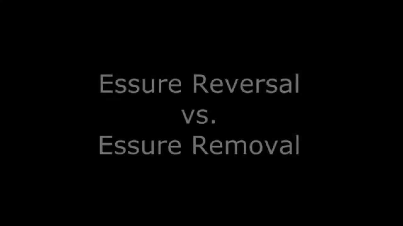 Essure Reversal vs Essure Removal - YouTube