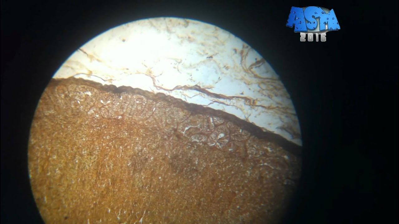 Histology of Supra-renal gland (silver stain) - YouTube