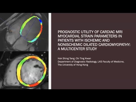 Prognostic Utility of Cardiac MRI Myocardial Strain Parameters - YouTube