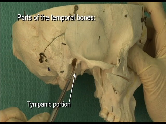 Petrotympanic Fissure Temporal_and_infratemporal_3.pdf