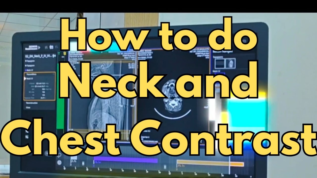 CT Scan Protocol: How to Perform Neck & Chest Contrast Study | Siemens ...