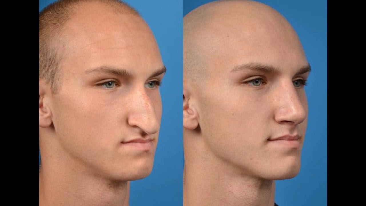 Pembedahan Plastik | CTU 211 - YouTube