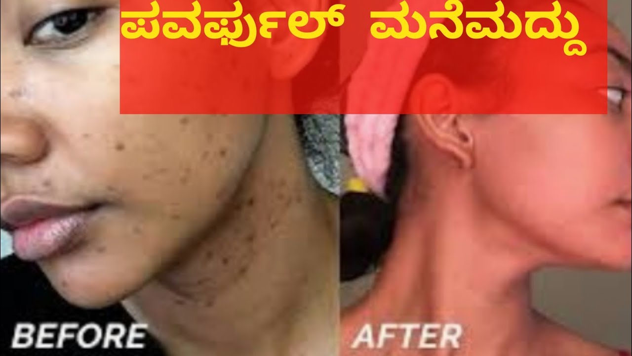 mukadha Sowndharya hechisalu 😲balasi akki hittu face pack - YouTube