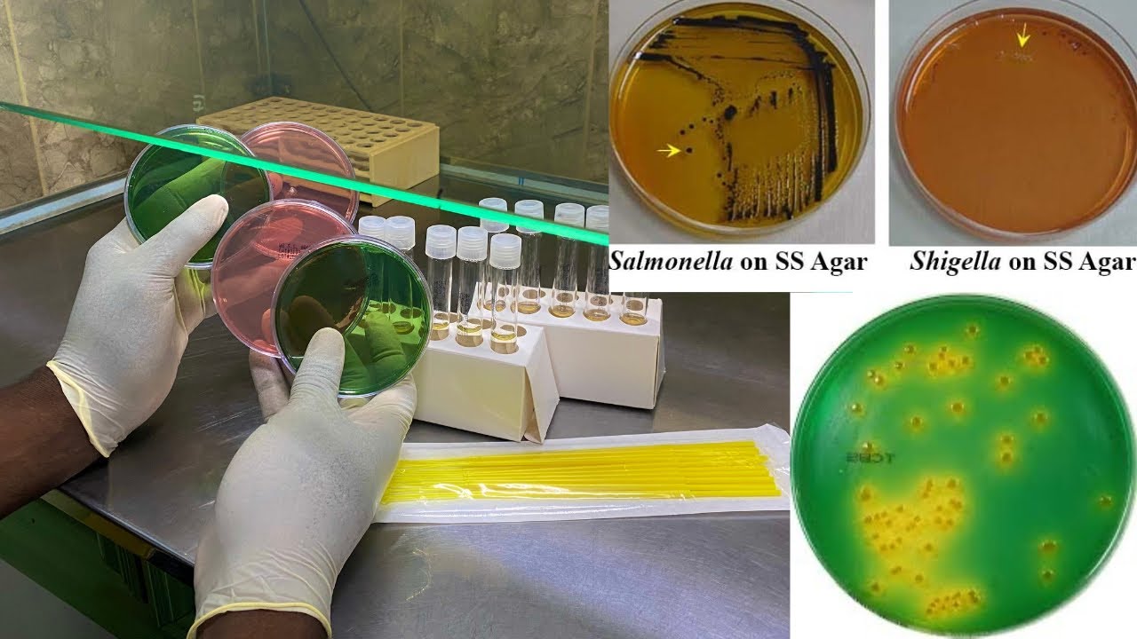 مزرعة السالمونيلا و الشيجيلا و الكوليرا culture Salmonella, Shigella ...