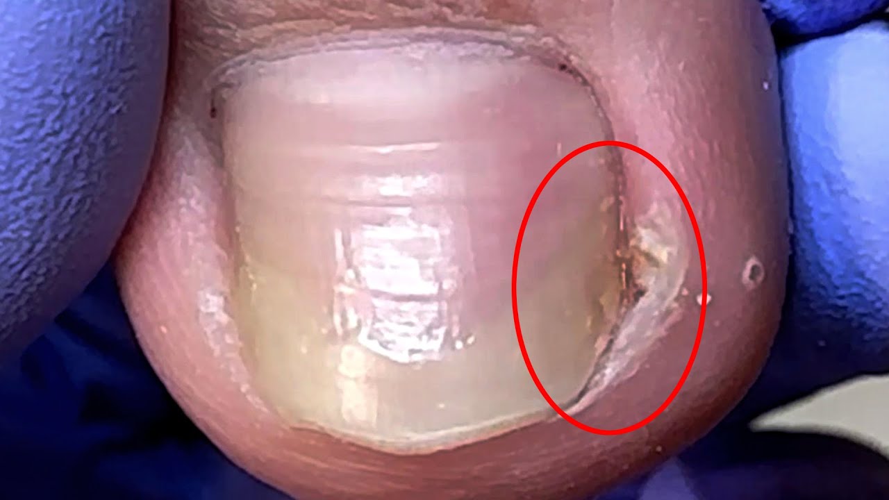 Wow~ It seems that the nail is deeply embedded, how to deal with it ...