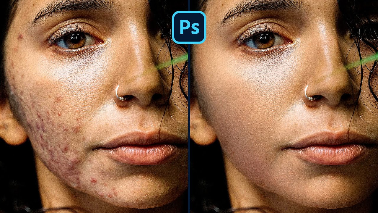 ACNE REMOVAL ⚡ Photoshop Tutorial - YouTube