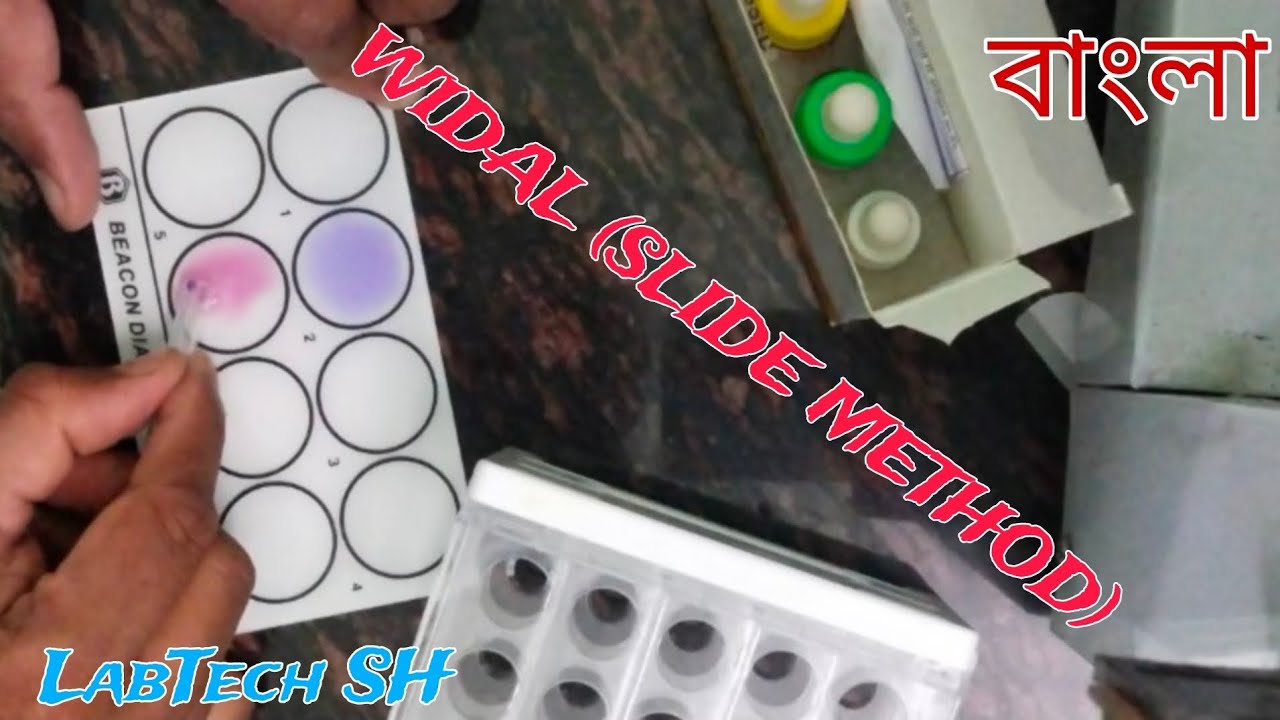 Widal Test | How To Test the Widal Slide Method | T-1 | LabTech SH ...