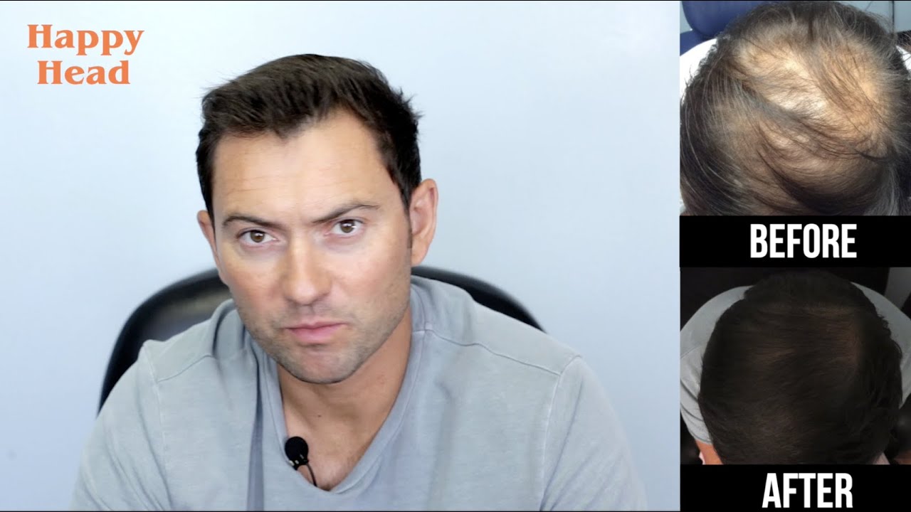 Happy Head Testimonial Video #33 - YouTube