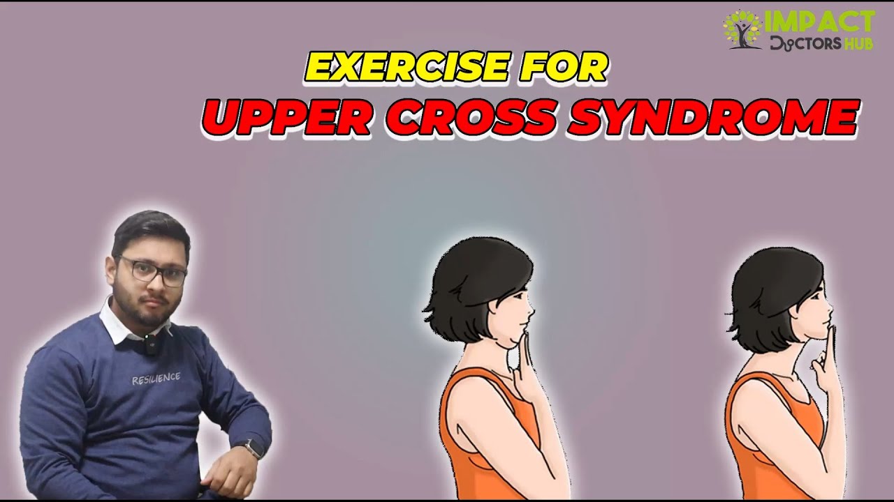 Upper Cross Syndrome | Impact Doctor Hub - YouTube