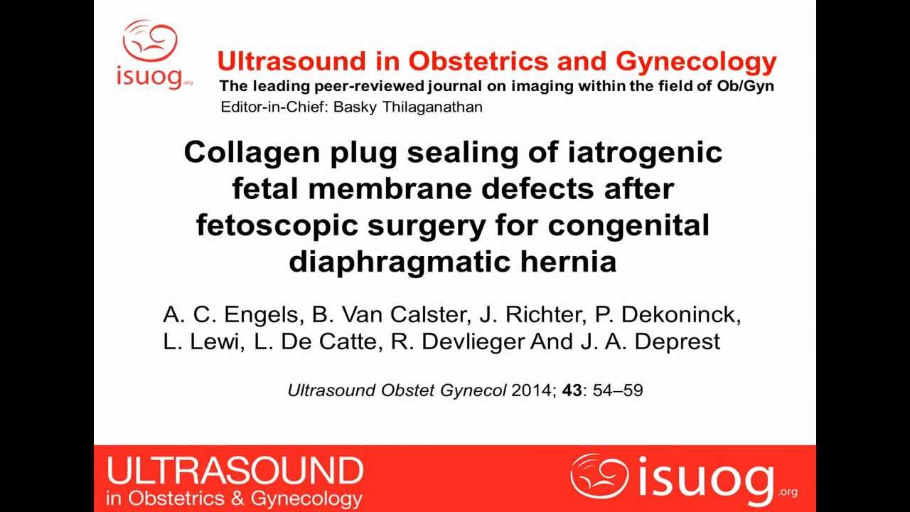 Collagen plug placement after fetoscopic surgery - YouTube