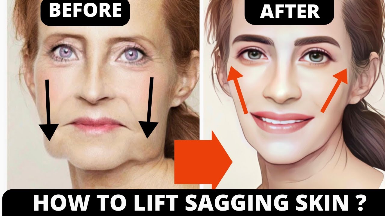 🛑 FACE LIFTING EXERCISES FOR SAGGING SKIN, JOWLS, LAUGH LINES, FOREHEAD ...