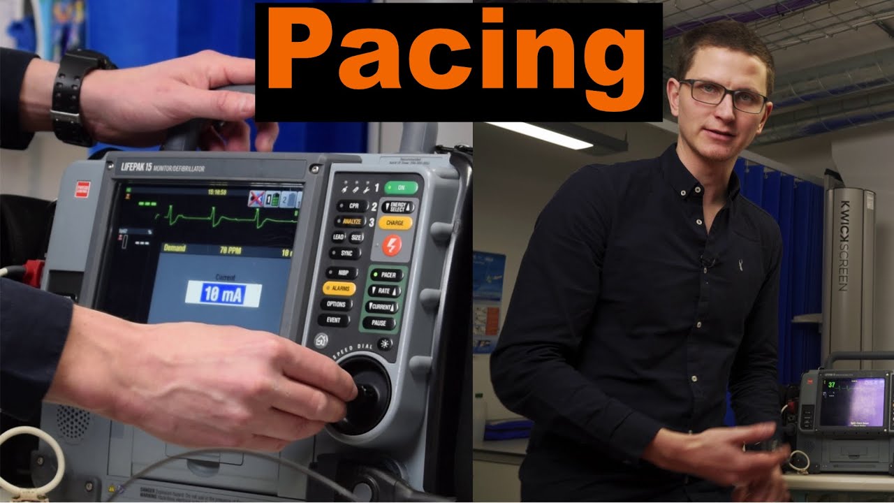How to Perform Pacing Step by Step Guide for Paramedics and Healthcare ...
