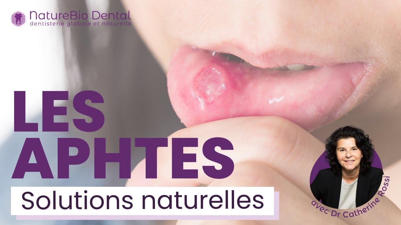 Aphtes, solutions naturelles - YouTube