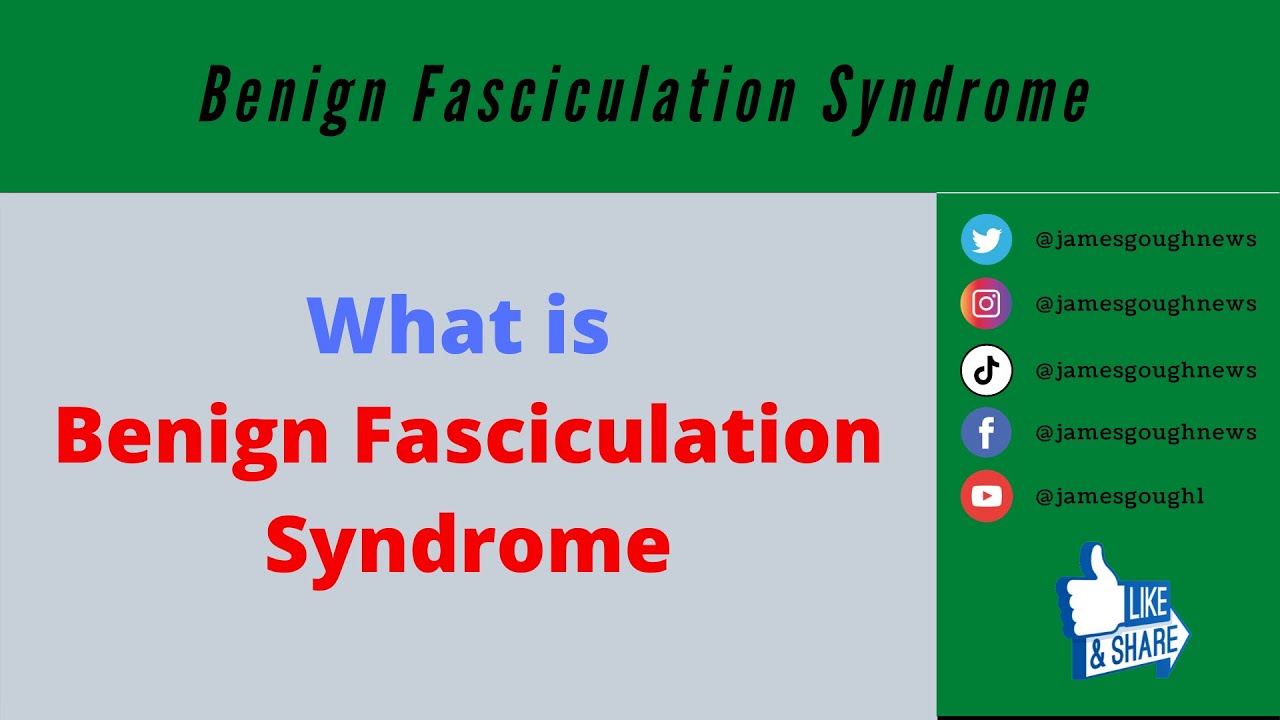 What is Benign Fasciculation Syndrome - YouTube