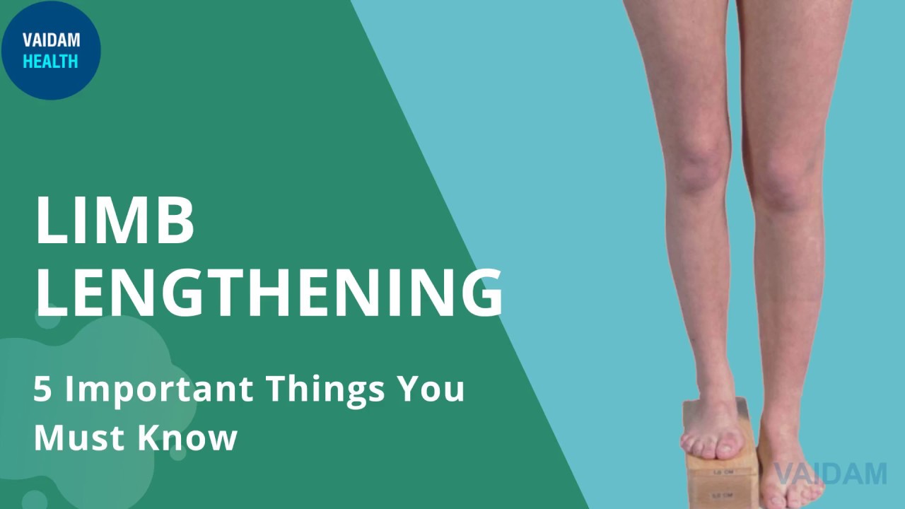 Limb Lengthening- 5 Important Things To Know - YouTube