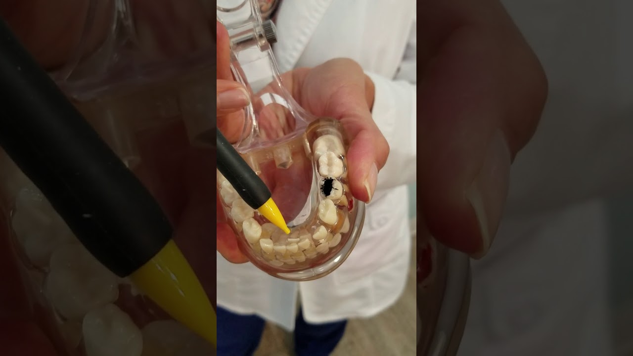 Common Questions from Parents: Over Retained Teeth - YouTube