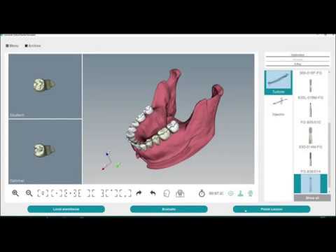 3D Lesson - Operative Dentistry - YouTube
