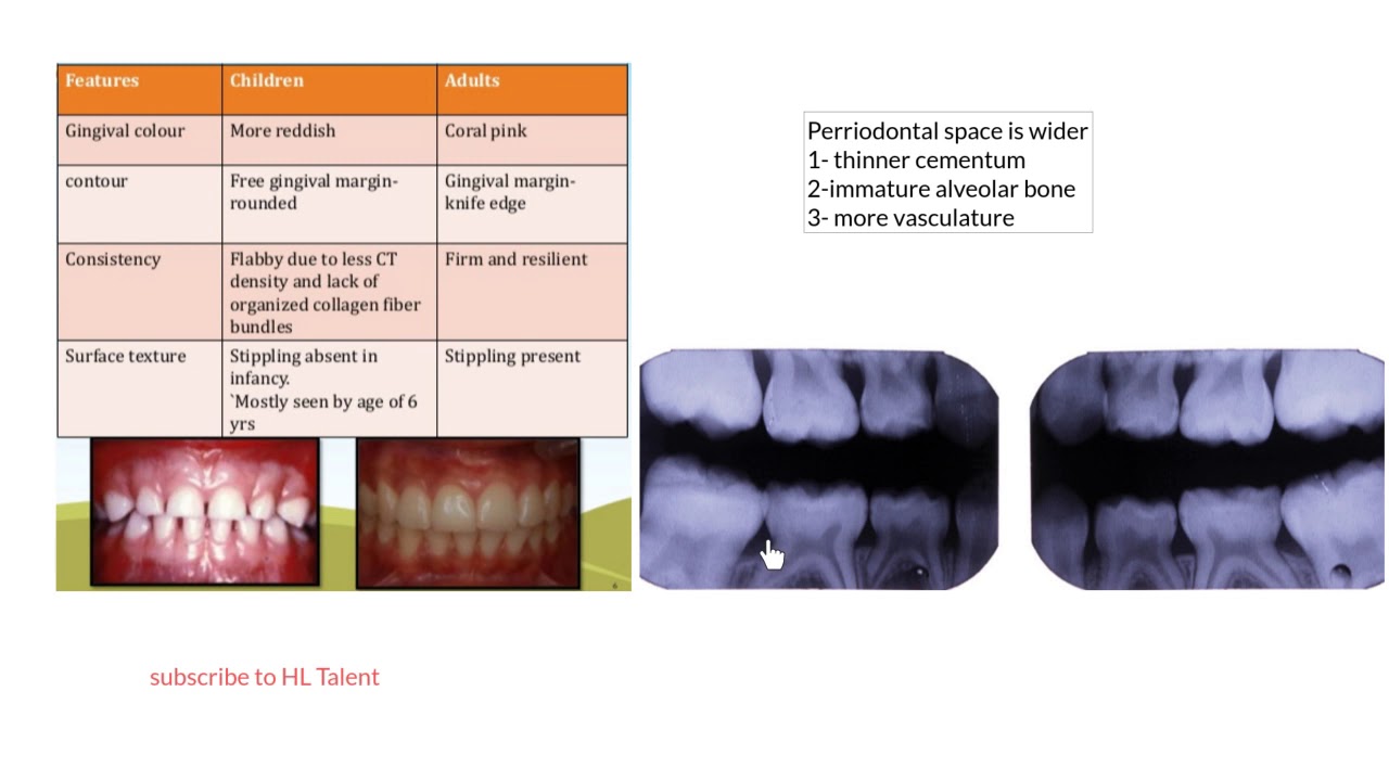Healthy Periodontium 2 - YouTube
