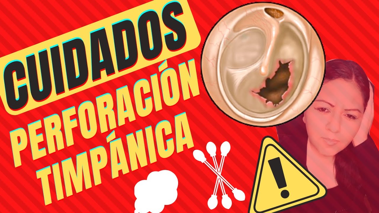 ⚠Cuidados para recuperación de TÍMPANO PERFORADO. Oído Seco y más ...