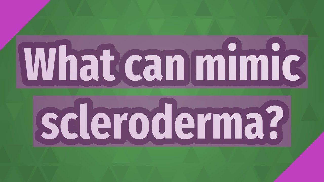 What can mimic scleroderma? - YouTube