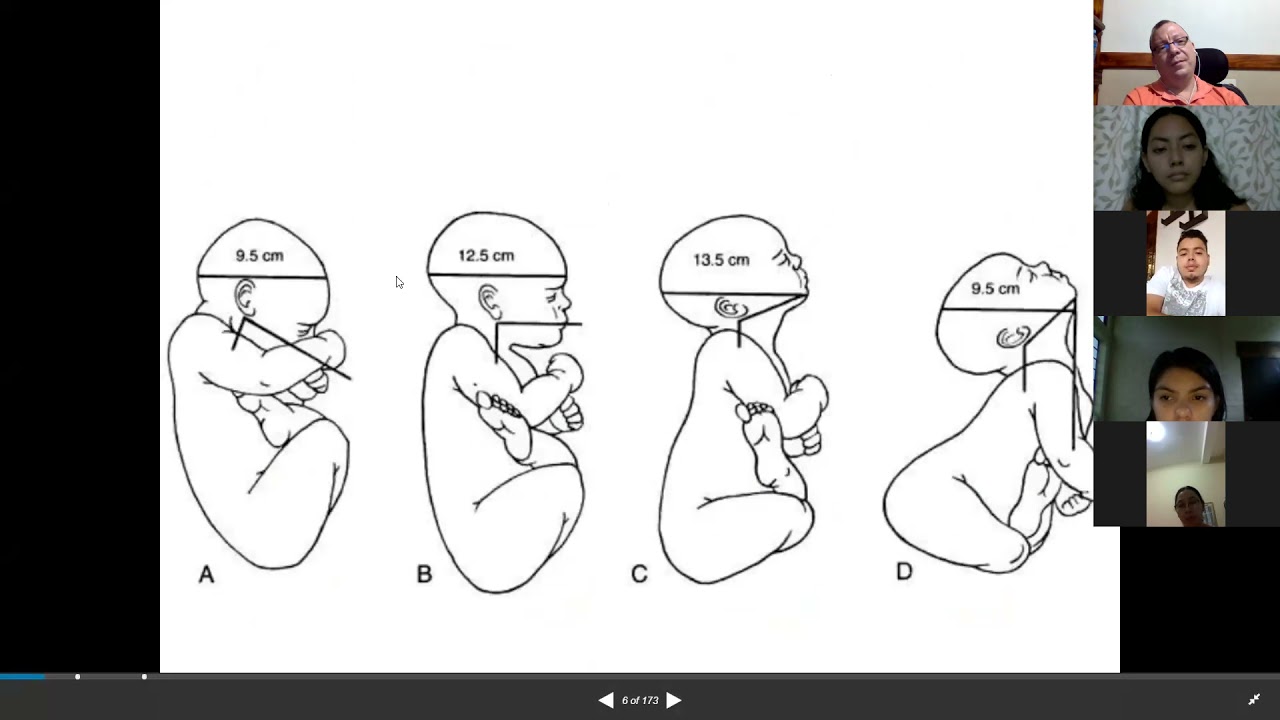 Presentación De Vértice Durante El Embarazo