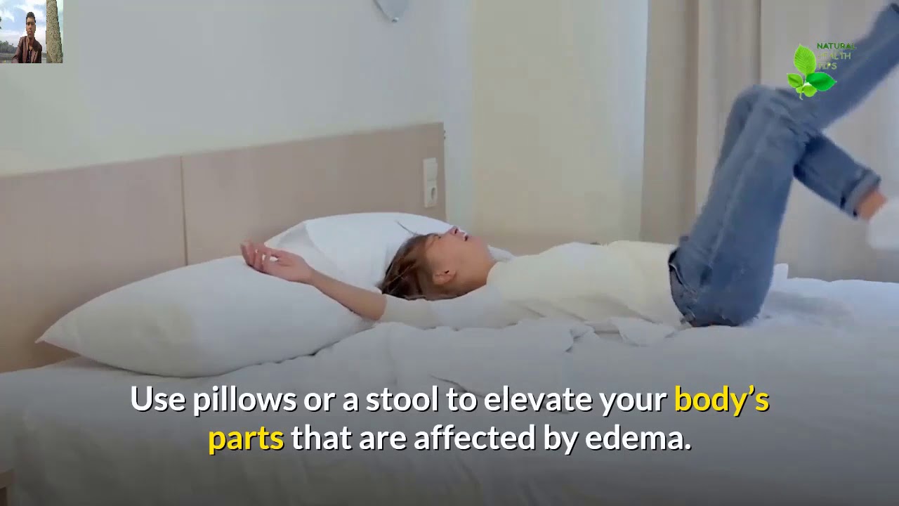 how to get rid of edema in legs fast and naturally 10 effective ways ...