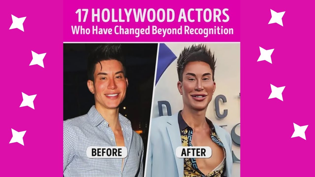 17 Hollywood Actors Who Have Changed Beyond Recognition - YouTube
