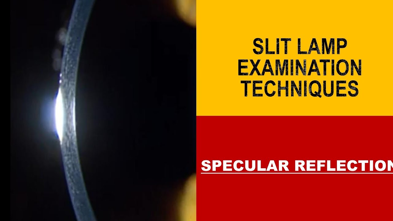 SPECULAR REFLECTION in SLIT LAMP | All you need to know - YouTube