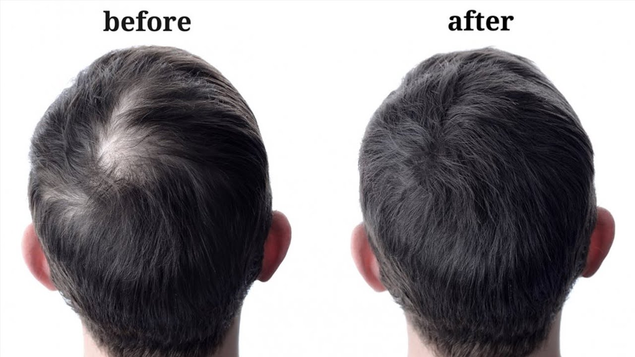 Nofap/Semen Retention Helps with Hair Growth? - YouTube