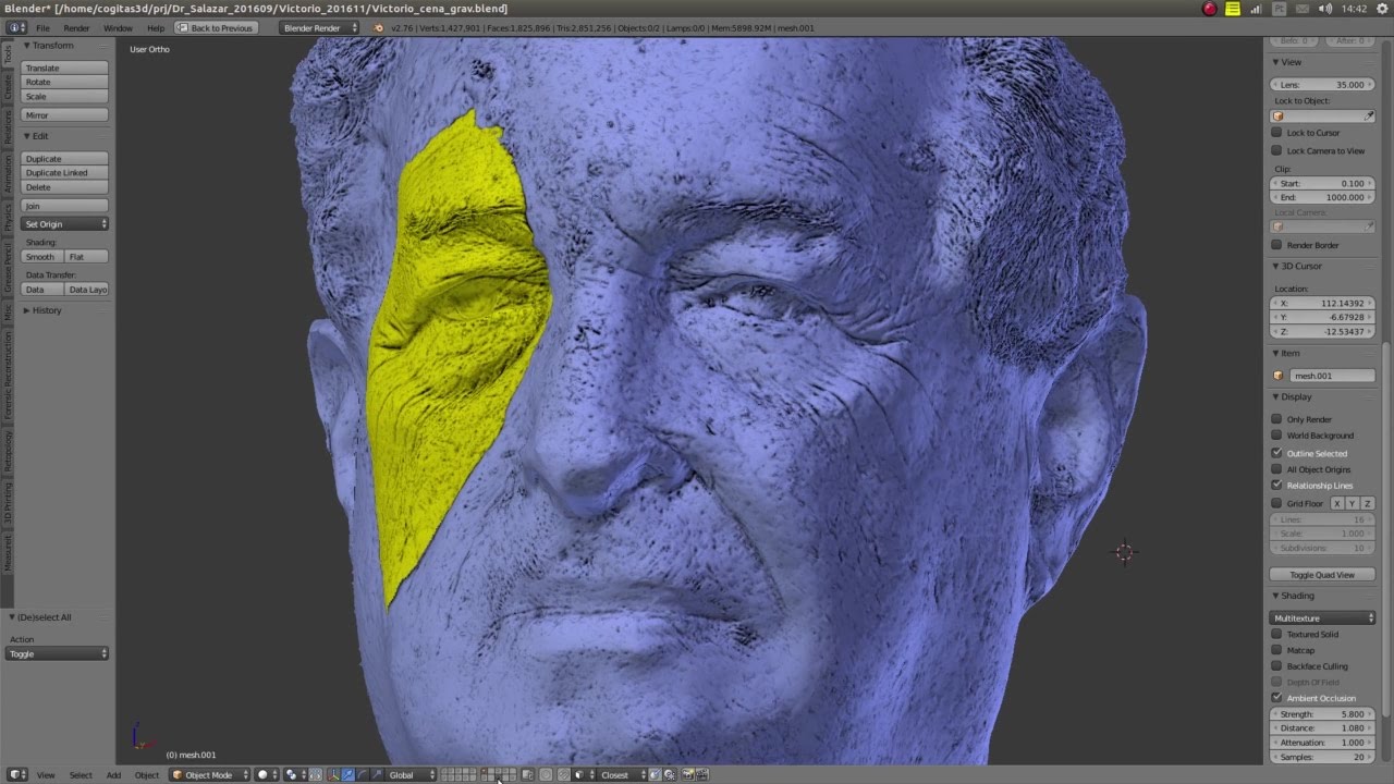 Human facial prosthesis with aid of 3D printing - YouTube