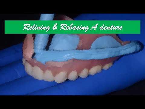 INBDE-Dental decks- Relining & Rebasing A Denture-Prosthodontics - YouTube