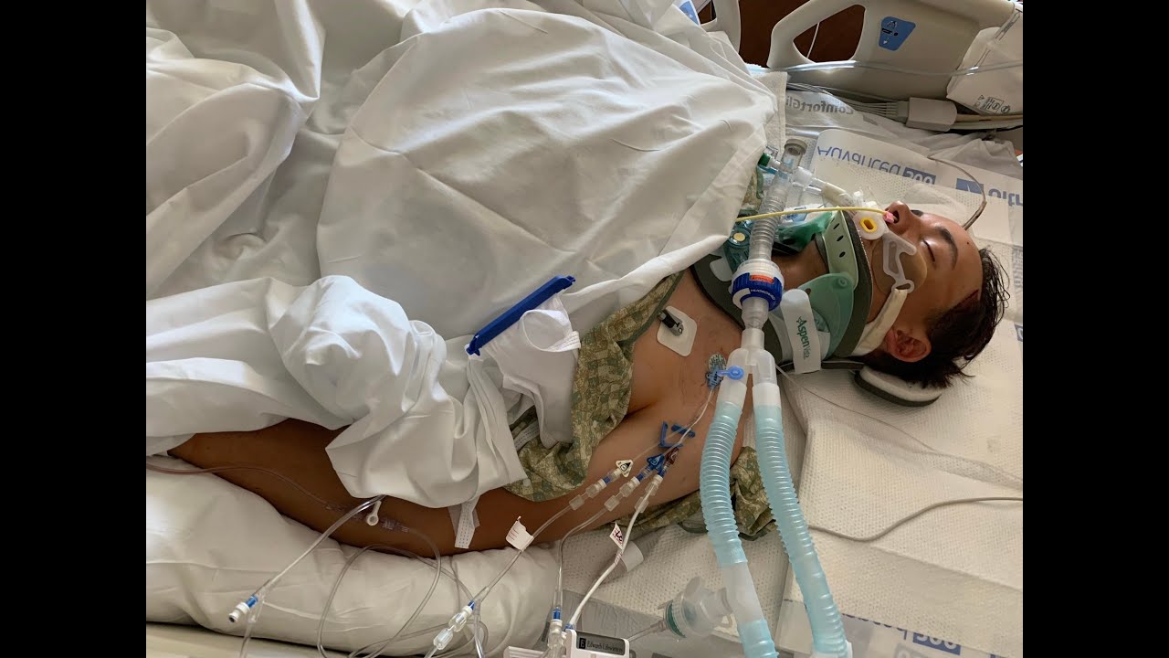 My Spinal Cord Injury Recovery Story | C1 and C2 Vertebrae Fracture ...